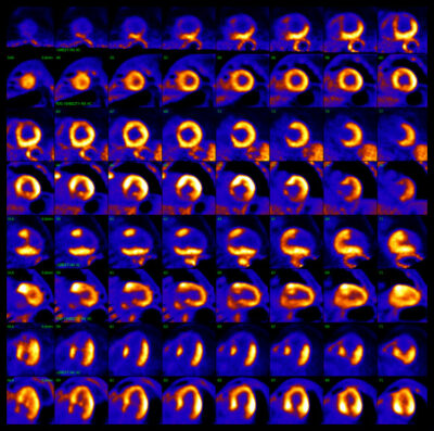 PET CT Scan For Cardiology | MIC Medical Imaging