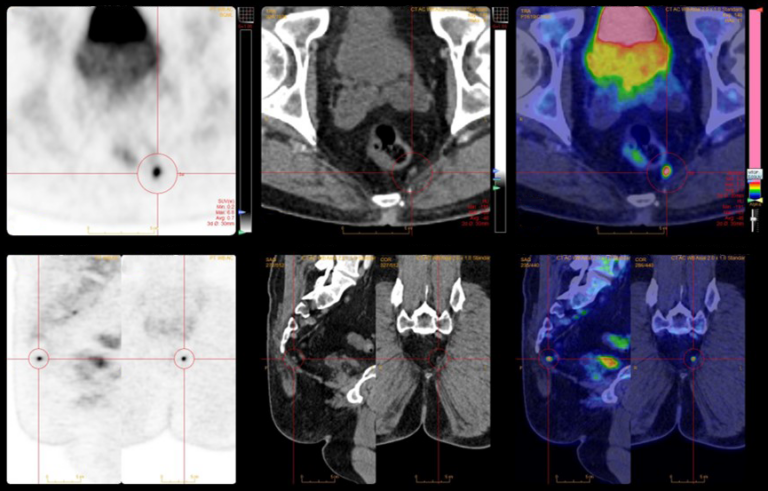 PET CT Practitioner Applications | MIC Medical Imaging
