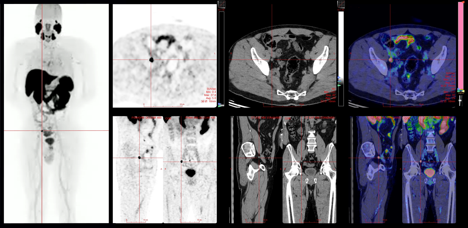 PET CT Practitioner Applications | MIC Medical Imaging