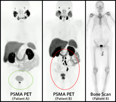 PET CT Practitioner Applications | MIC Medical Imaging
