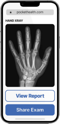 PocketHealth Instructions | MIC Medical Imaging